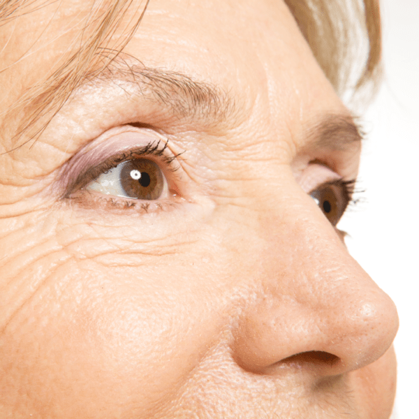 Rimpels.... wat zijn ze, hoe ontstaan ze, en hoe voorkomen we ze ...